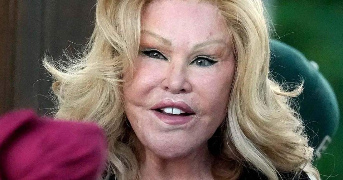 La Vérité Choquante Enfin Révélée Jocelyne Wildenstein Jure Navoir Jamais Touché à La